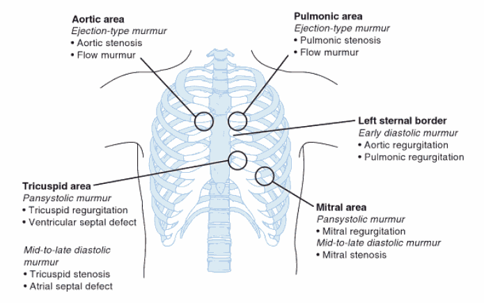 Exam 1 | PANCE and PANRE Practice Exam