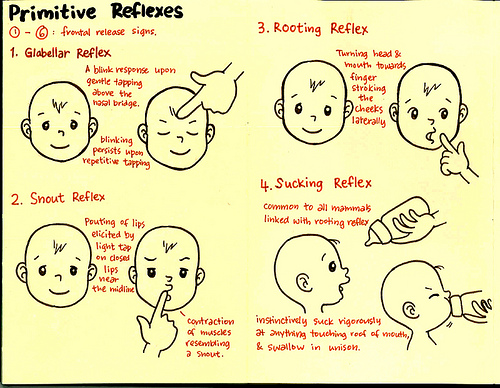 Exam 4 | PANCE and PANRE Practice Exam