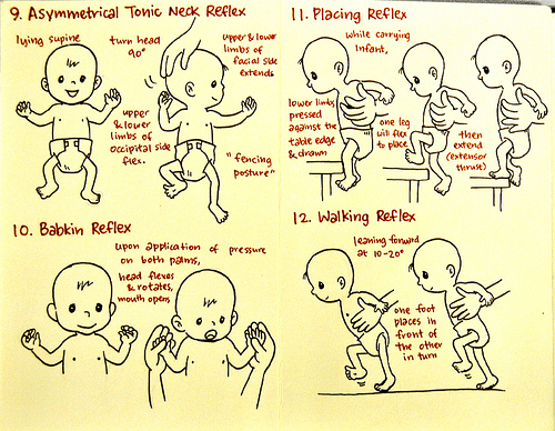 Exam 4 | PANCE and PANRE Practice Exam
